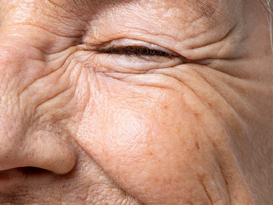 Pigmentflecken: Ursachen, Behandlung und Vorbeugung | Garnier